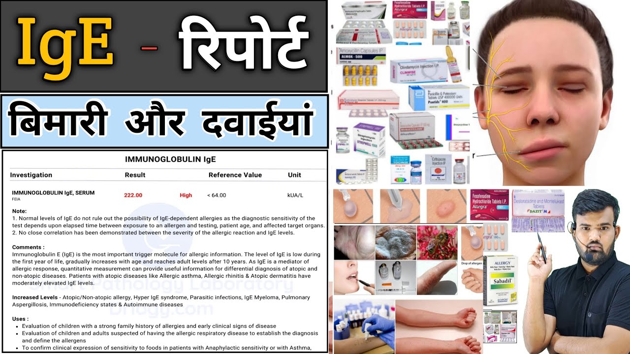 IgE रिपोर्ट | Medicine | Medicine Knowledge | Treatment | Disease ...
