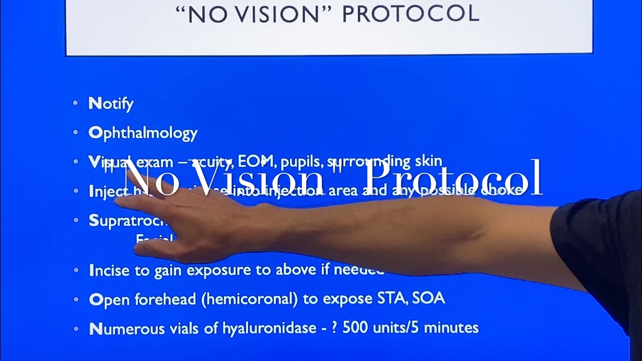 Filler Associated Blindness - Review Of Literature & No Vision Protocol ...