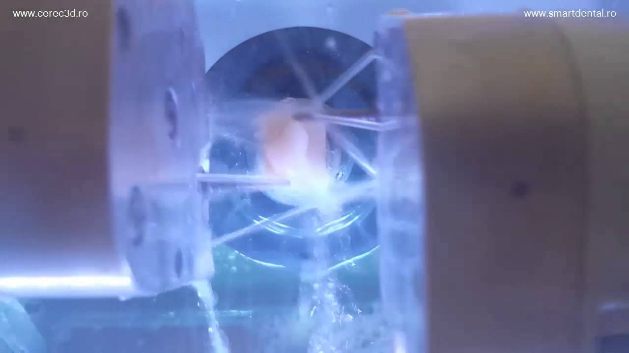 CEREC Omnicam MCXL -ceramic inlay onlay milling - Cluj Napoca - YouTube