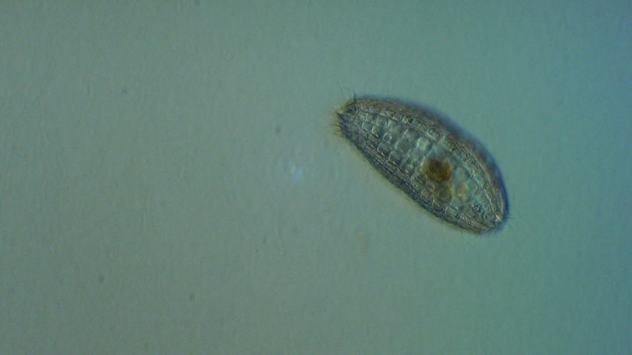 Ciliate: Coleps sp. - YouTube