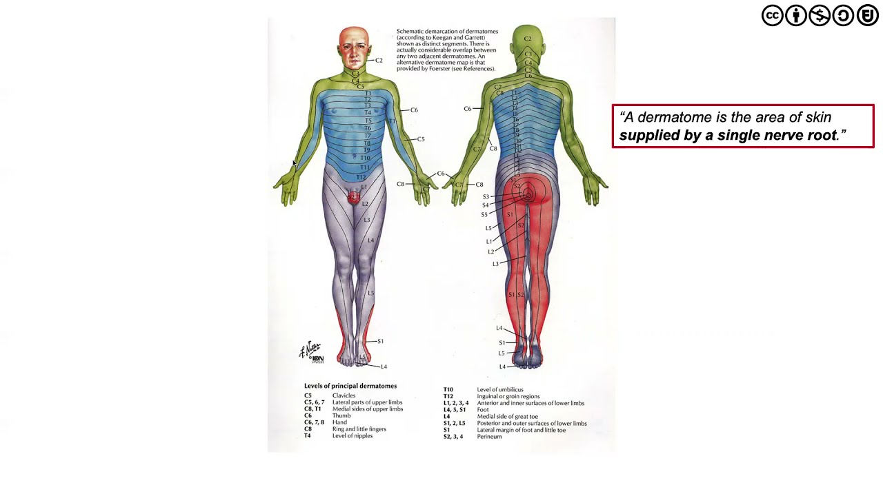 Dermatomes Anatomical Chart Lippincott Williams Wilkins