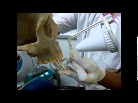 PARALLELING TECHNIQUE/ LONG CONE TECHNIQUE/RIGHT ANGLE TECHNIQUE - YouTube