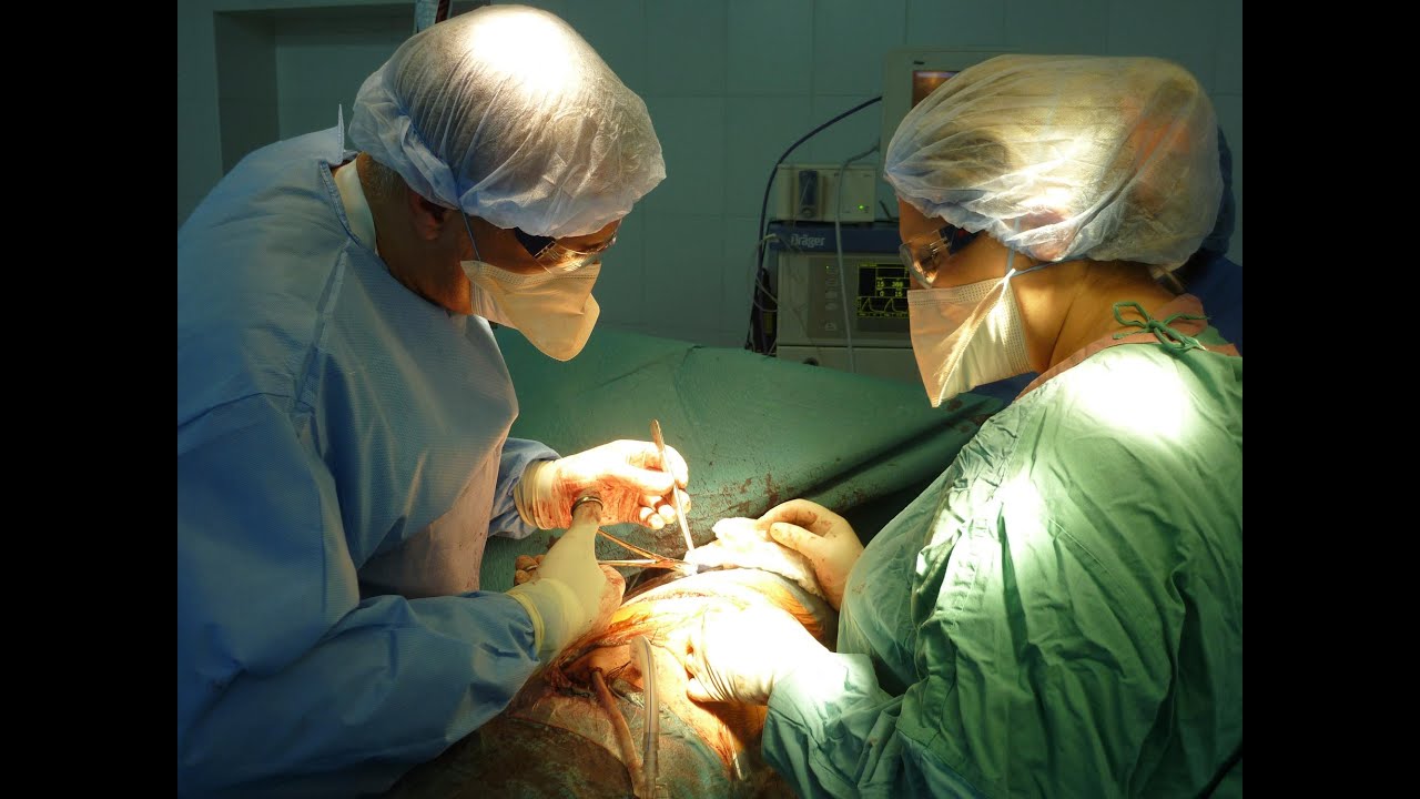 Left Lower Lobectomy for Bronchiectasis : From an operative workshop ...