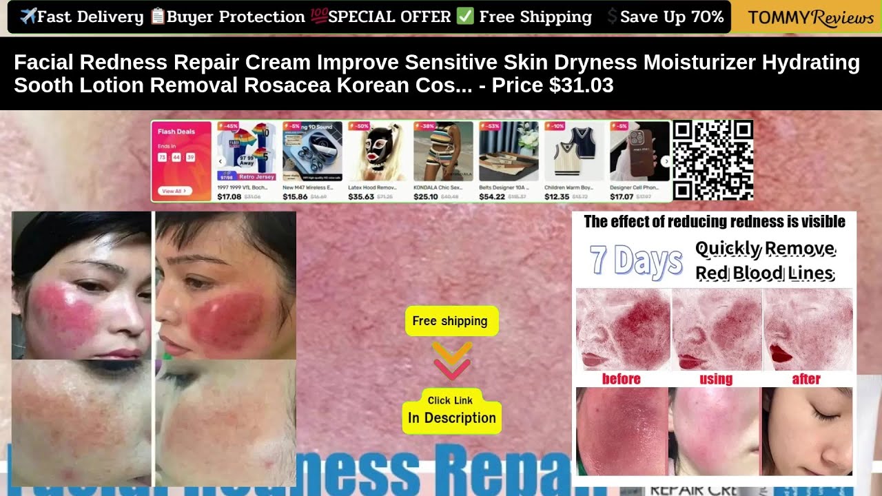 Facial Redness Repair Cream: Soothe Sensitive Skin & Rosacea | # ...