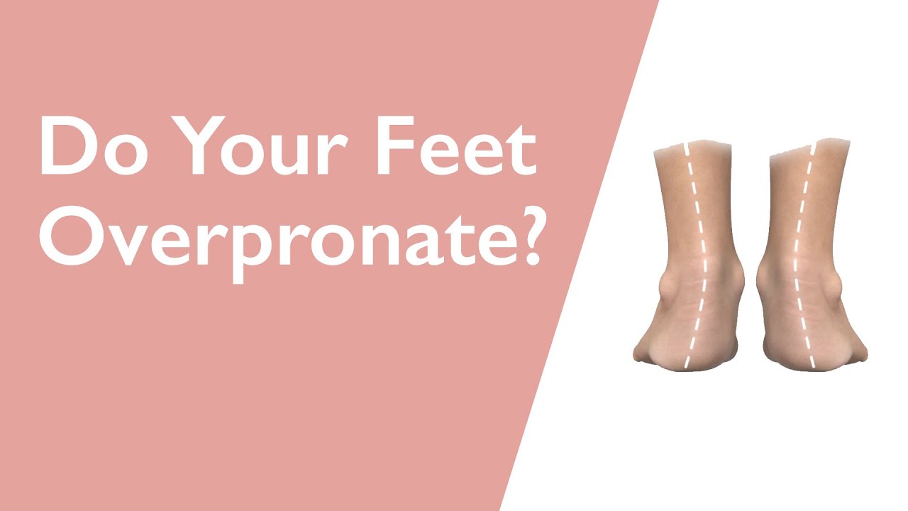 Low Arches & Best Orthotics - YouTube
