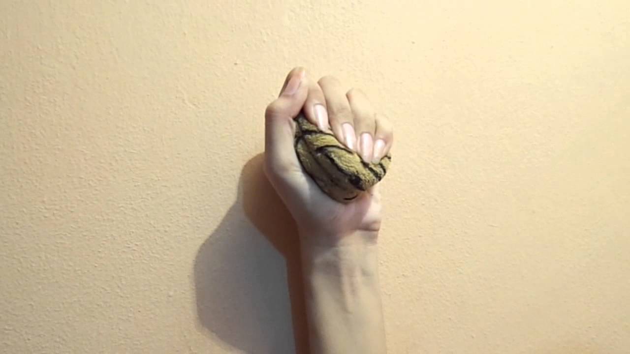 OSWA Hand Grip Wide Awake Hand Surgery (WAHS) - YouTube