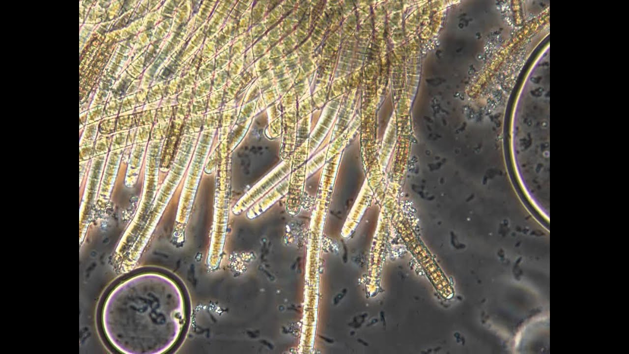 Trichodesmium - YouTube