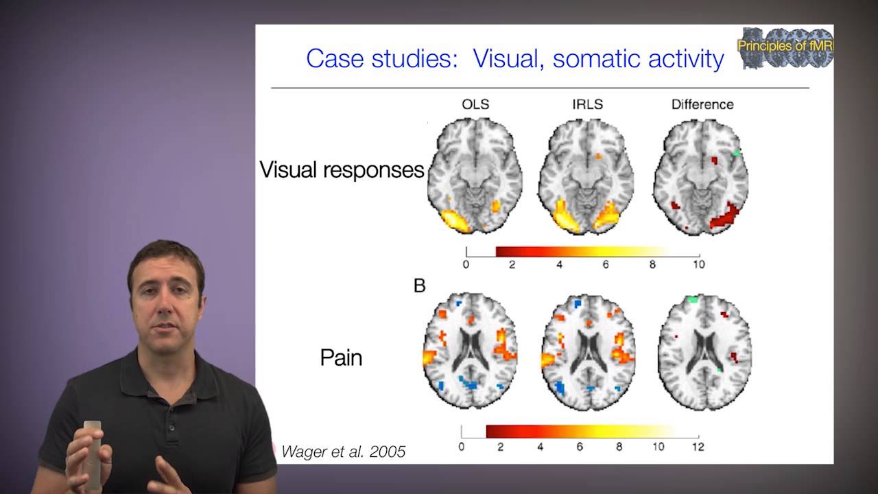 Principles of fMRI, Part 2, Module 14 - Robust regression - YouTube