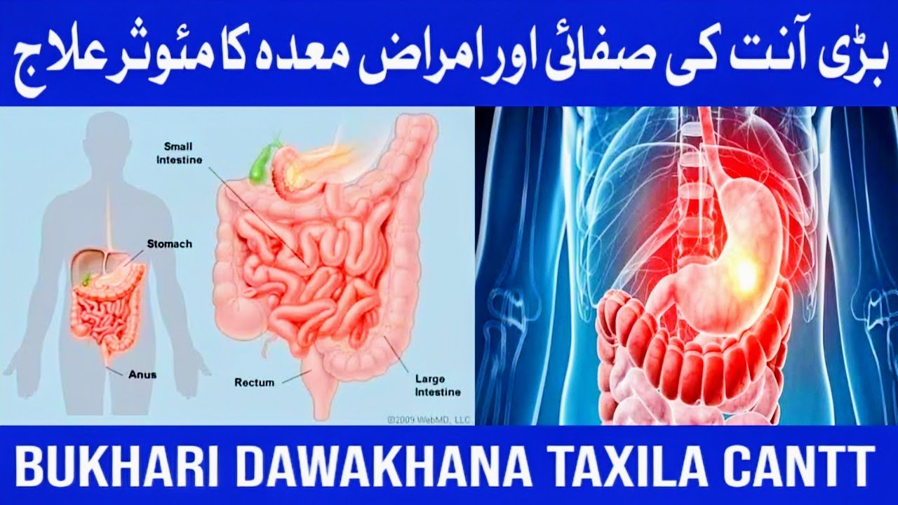 Badi Aant ki Safai aur Amraz-e-Maida ka Moasser Ilaj | بڑی آنت کی صفائی ...