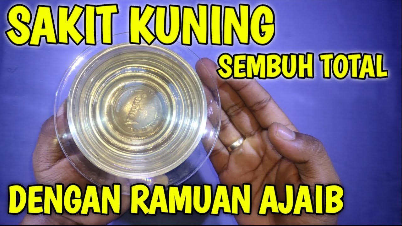 Tak perlu ke dokter!! Cara menyembuhkan sakit kuning secara alami ...