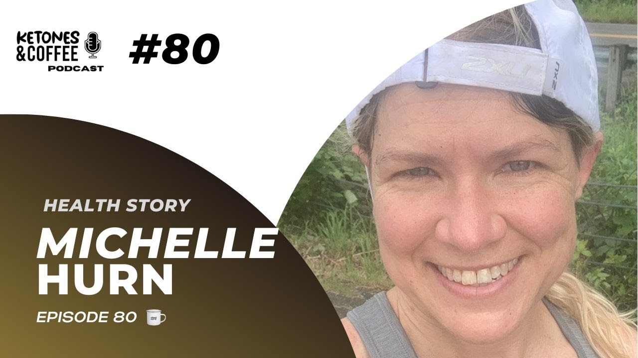 Michelle Hurn | The Dietitian's Dilemma - YouTube