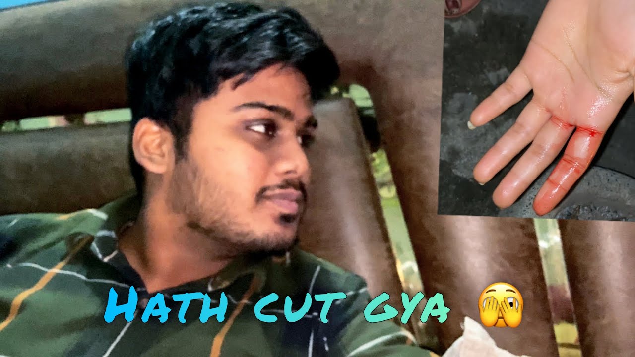 Hath Cut Gya 😱 |Amit Rai Vlogs|| - YouTube