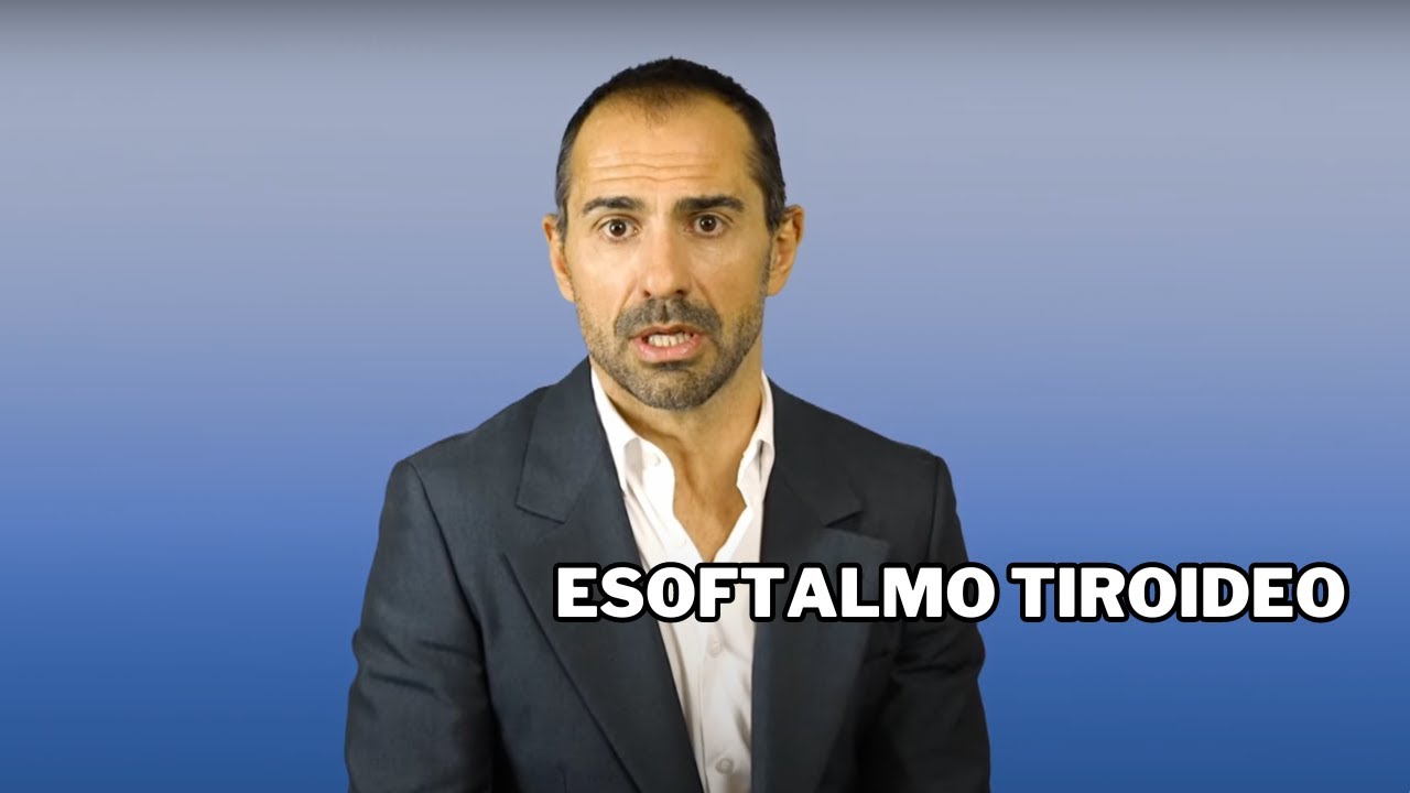 Esoftalmo Tiroideo - Occhi Sporgenti - Dr. Bernardini - YouTube