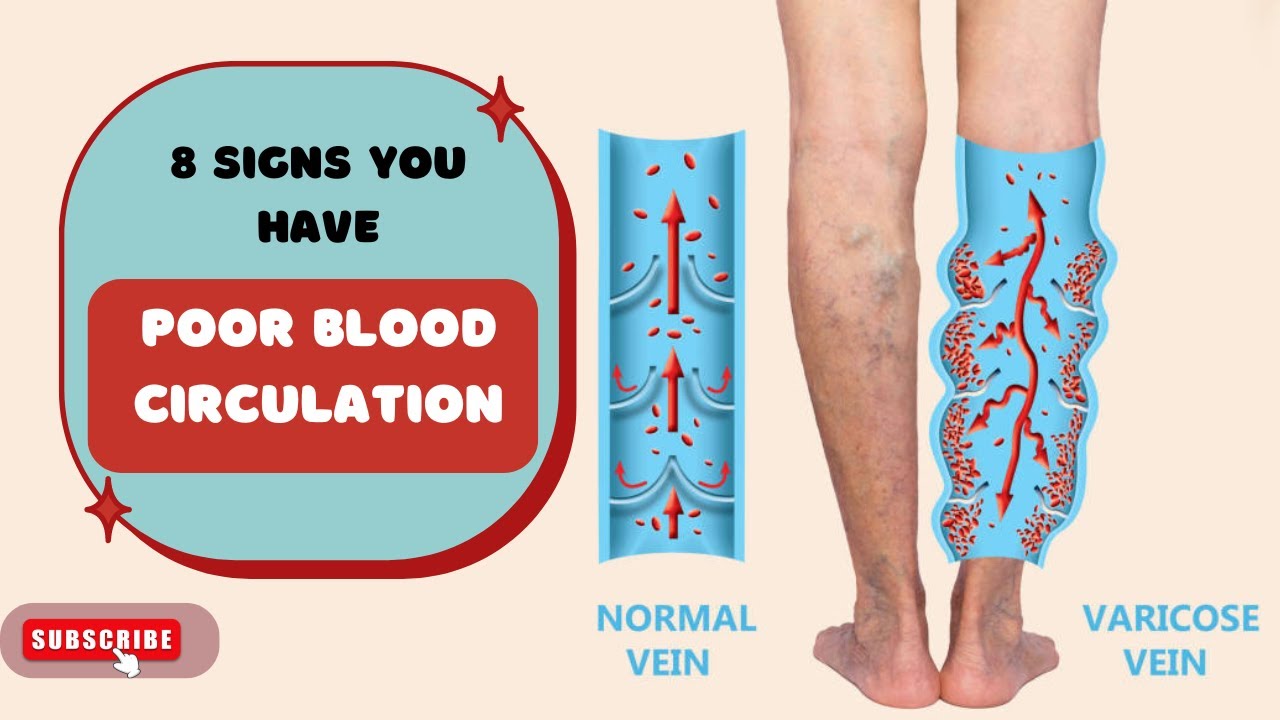 8 Signs You Have Poor Blood Circulation | Signs of Varicose Veins - YouTube