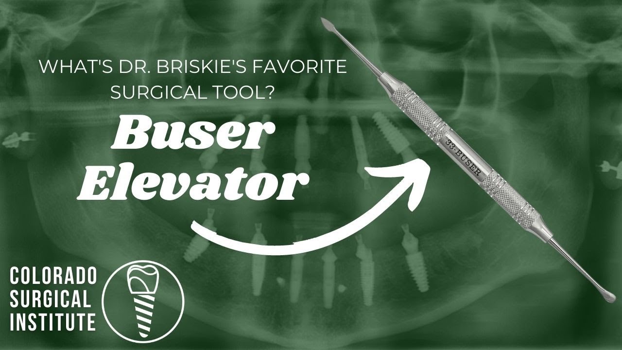 Buser Elevator: Dr. Briskie's favorite surgical tool! - YouTube