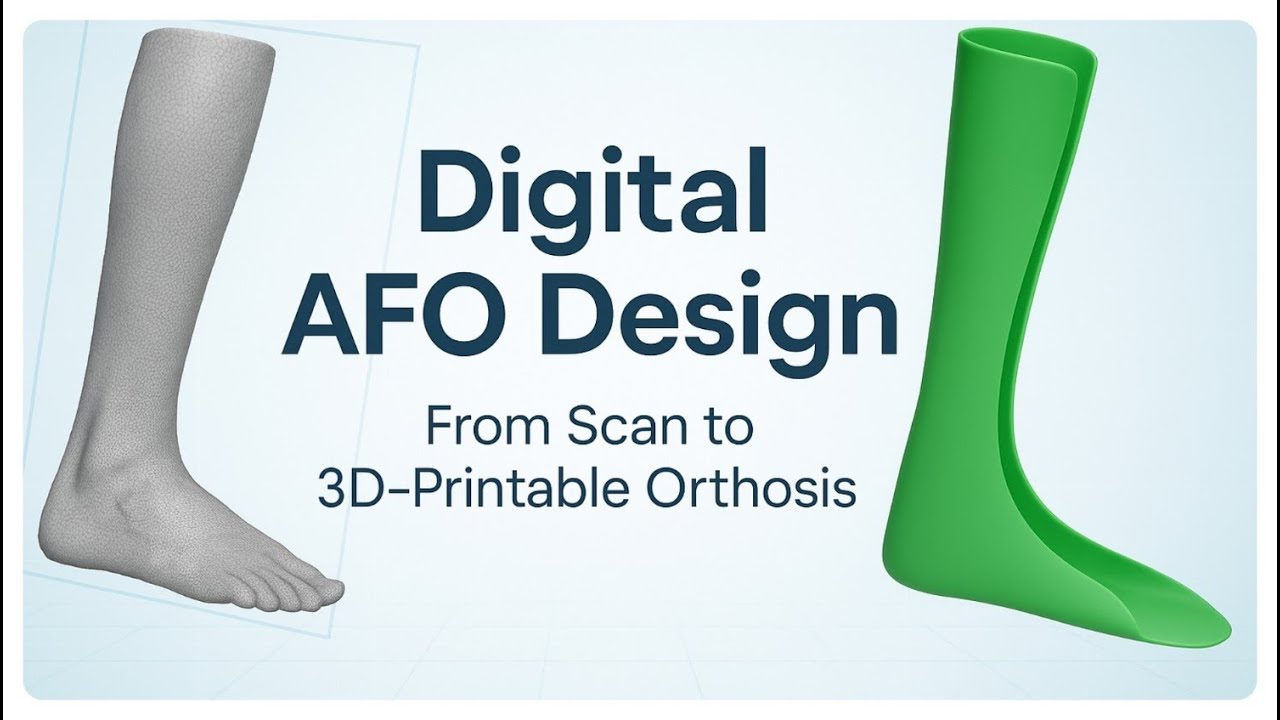 Step-by-Step Digital AFO Design | From Leg Scan to 3D Printable ...