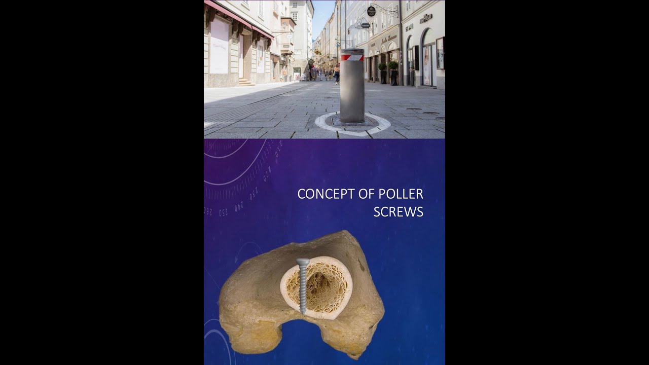 Poller screw basic concept - YouTube