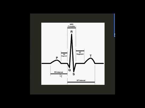 ECG PART 3 normal durations of various intervals and segments in ecg ...