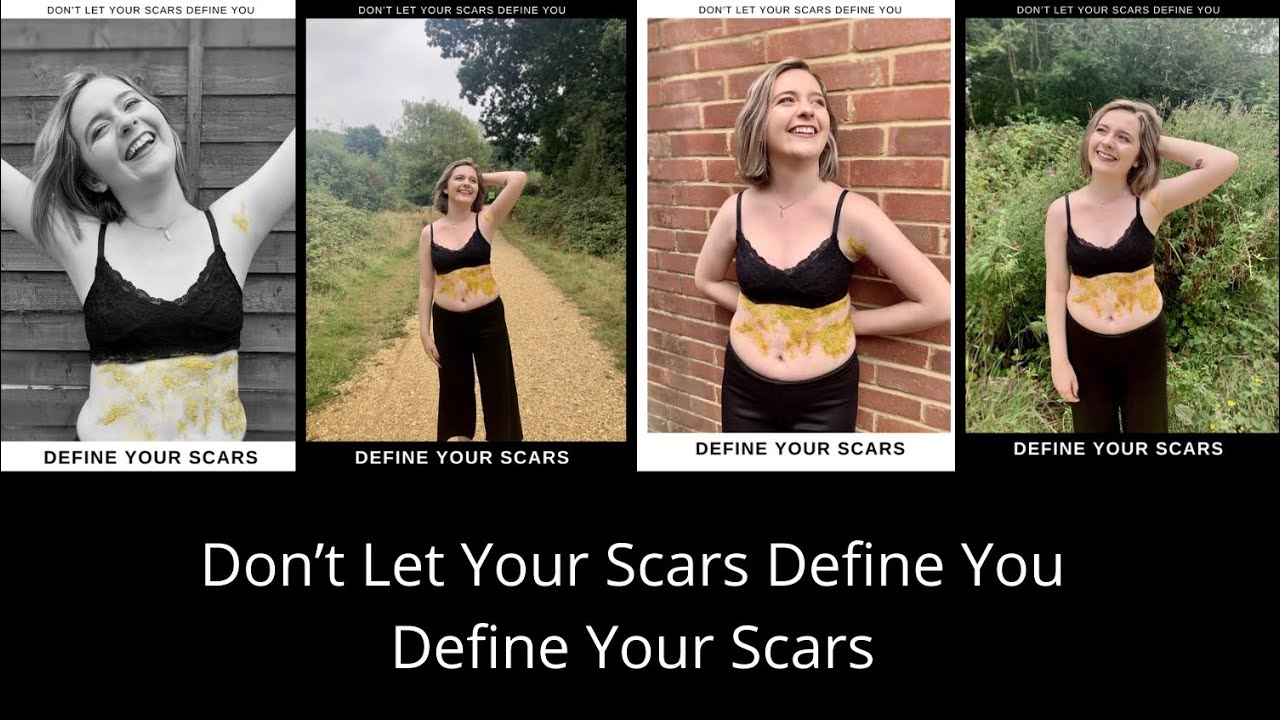 Making the ‘Define Your Scars' Campaign - YouTube