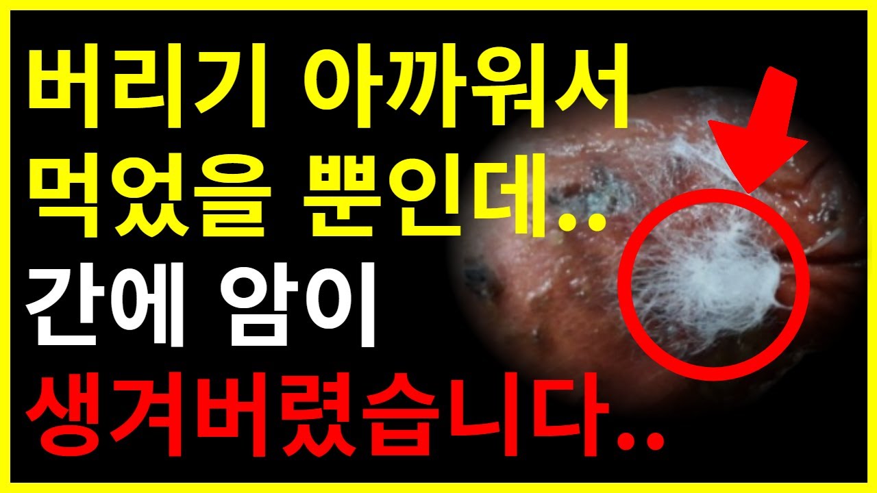 버리기가 아까워서 먹었을 뿐인데 간에 암이 생겨버렸습니다 암을 일으키는 음식 꼭 기억하세요 Youtube