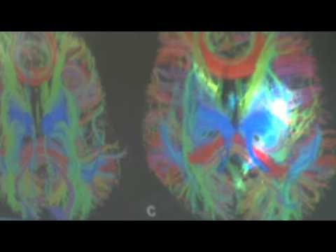 Η ΛΕΙΤΟΥΡΓΙΑ ΤΟΥ ΑΝΘΡΩΠΙΝΟΥ ΕΓΚΕΦΑΛΟΥ - YouTube
