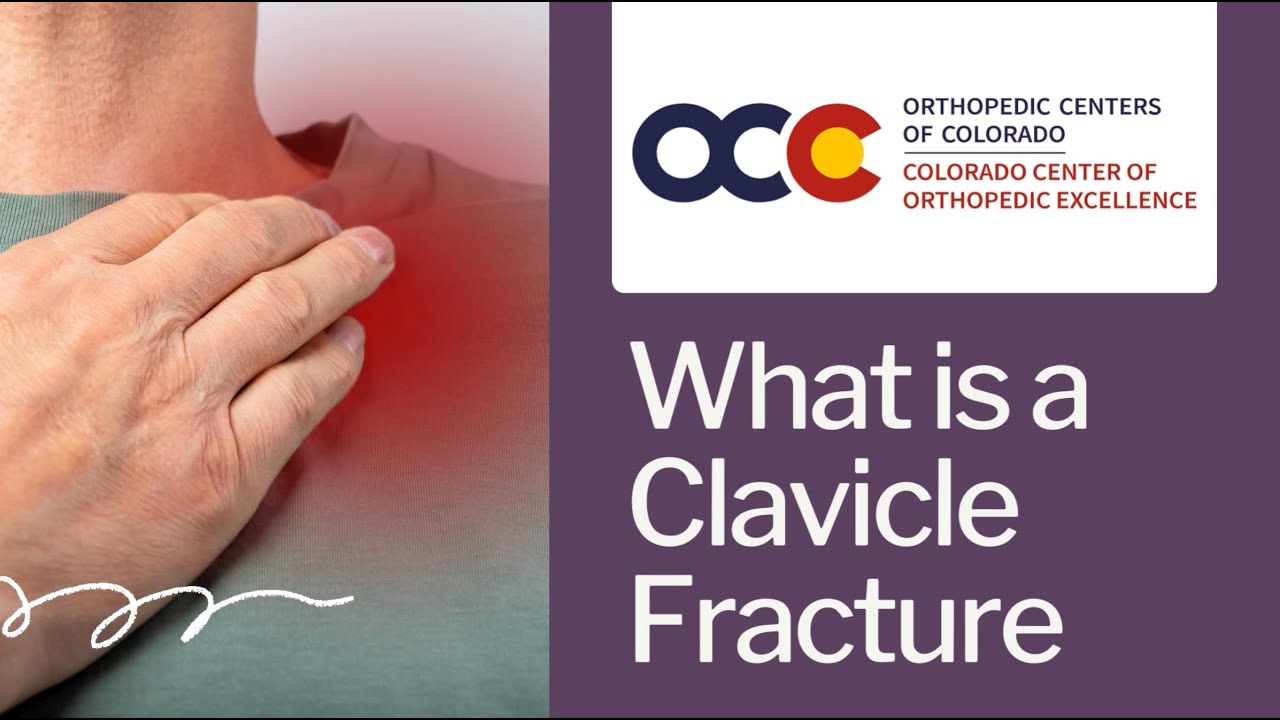 OCC - Colorado Center of Orthopedic Excellence presents: Understanding Clavicle Fractures - YouTube