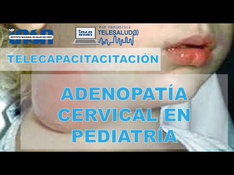 Adenopatía Cervical en Pediatría - Telecapacitación INSN - YouTube