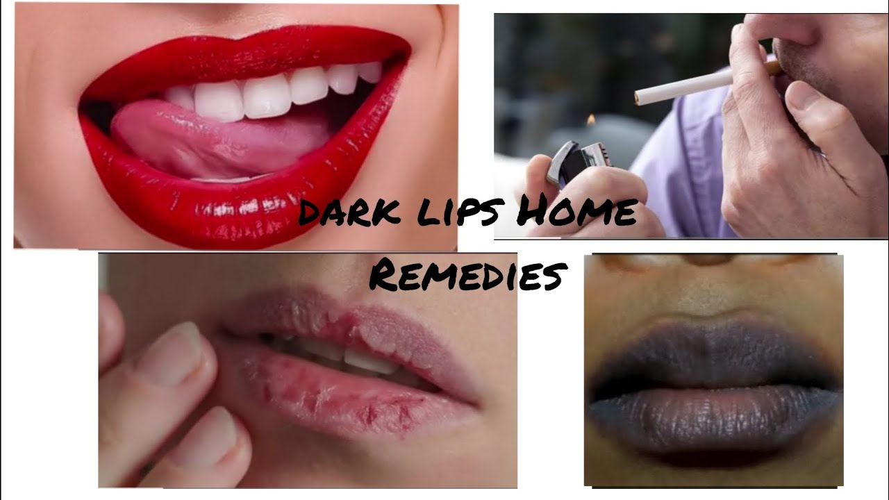 How to get rid of dark lips | lightrn dark lips | home remedies for ...