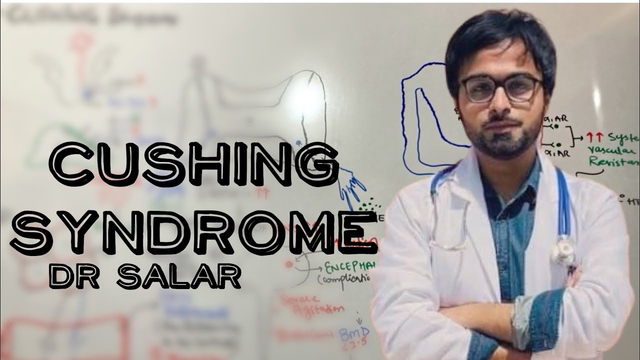 Cushing syndrome | Women's symptom of Cushing syndrome disease ...
