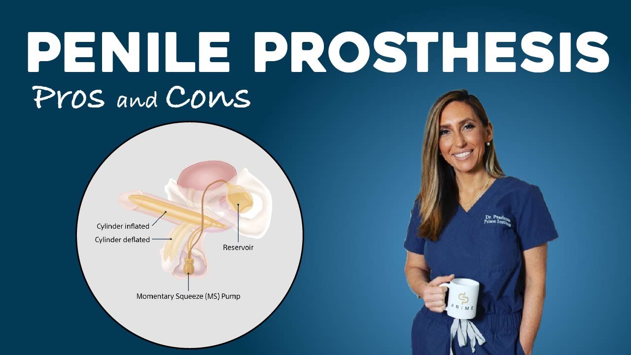Inflatable Penile Implant Ipp Benefits And Disadvantages Amypearlman408 Primeinstitutemiami