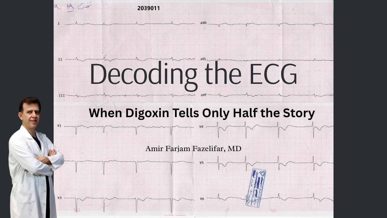 26: Decoding the ECG. When Digoxin Tells Only Half the Story. - YouTube