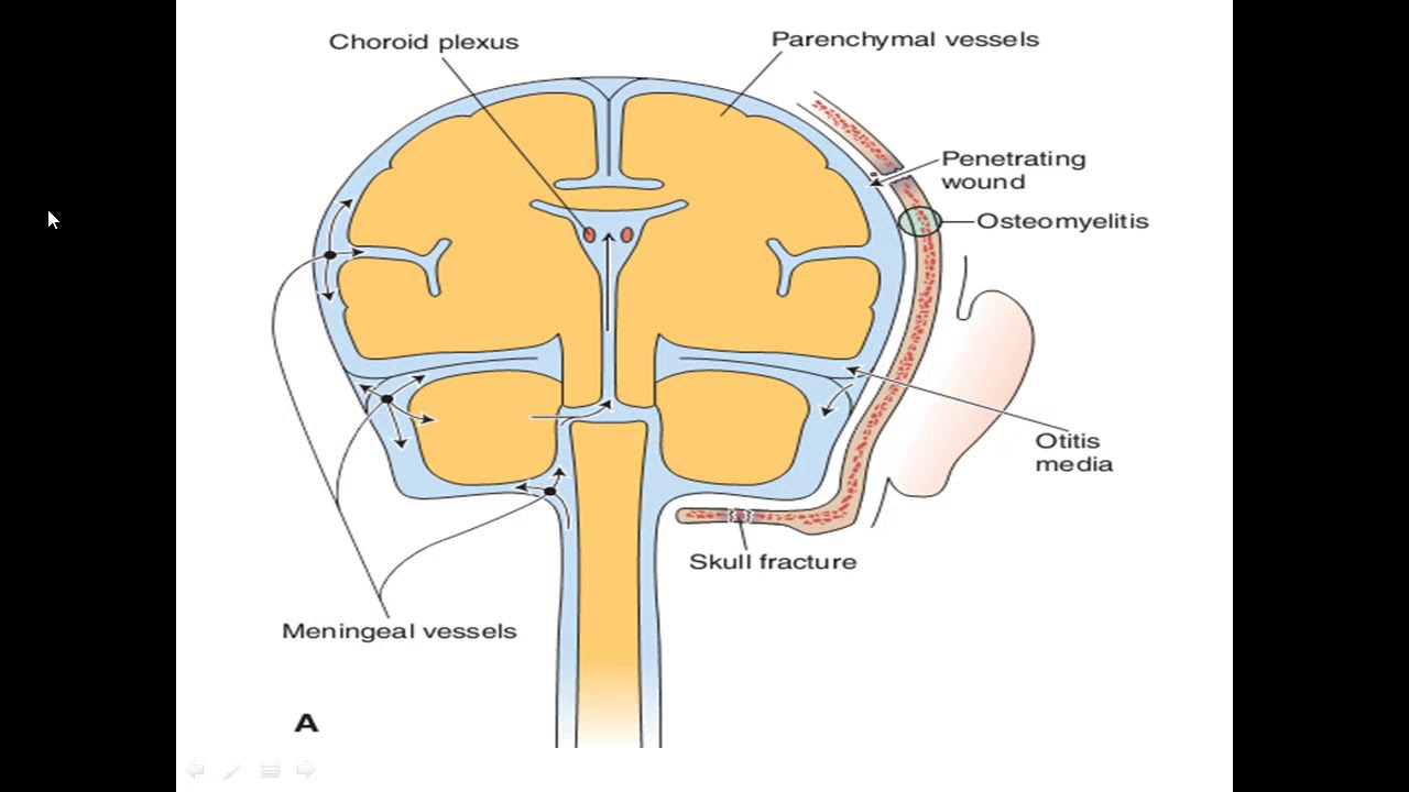 Pathology CNS 1 - YouTube