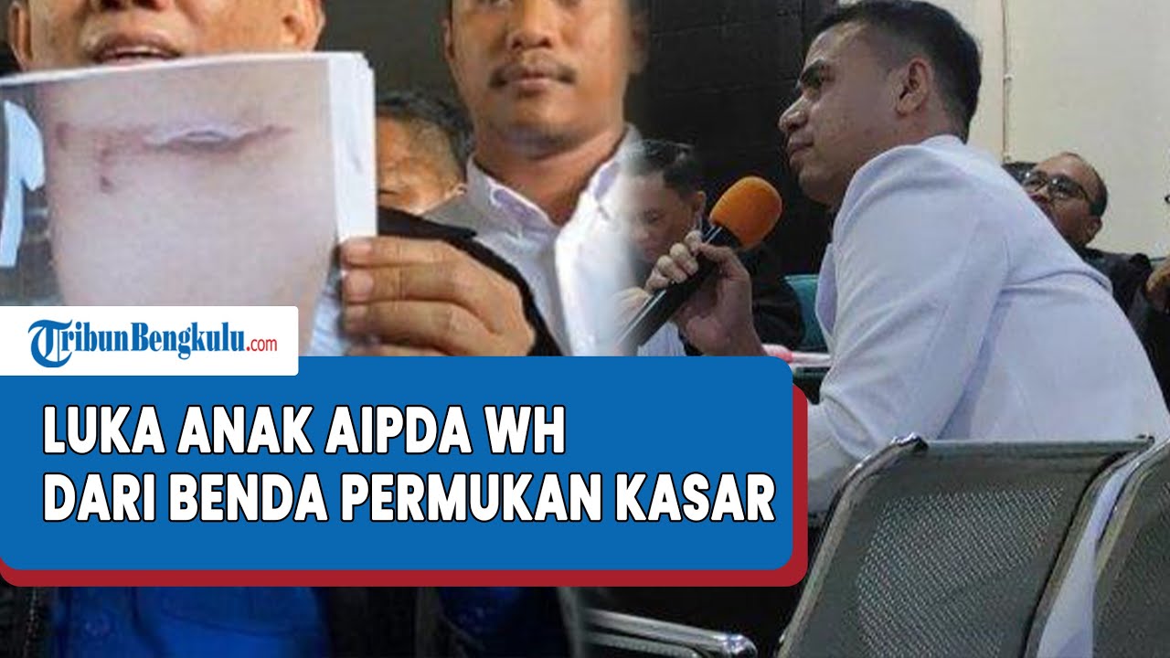 Dokter Forensik Sebut Luka Anak Aipda WH dari Benda Permukan Kasar ...