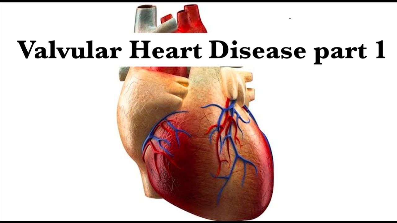 Valvular heart Diseases part 1(intro) by ASM Minds Team - YouTube