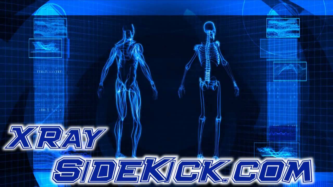 Skull Nasal Facial Bones Zygomatic Arches X Ray Radiography Positioning ...