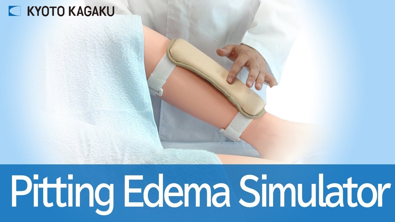 MW1 Pitting Edema Simulator - STR Simulation of Savannah, GA