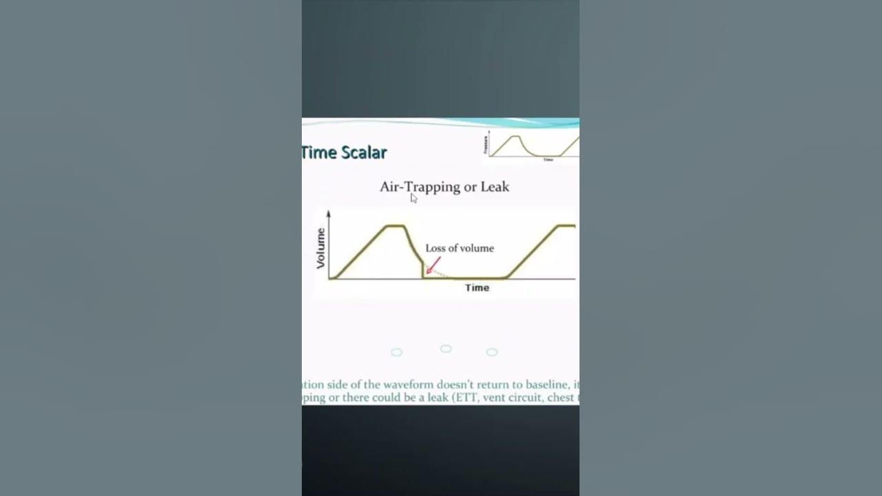 Air leak in volume time scalar ventilation graphics #graphics #waveforms #neonatalventilation ...