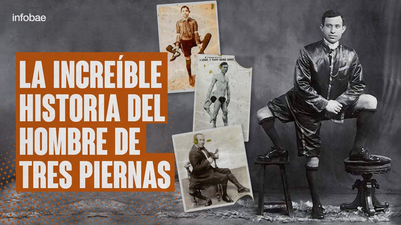 LA INCREÍBLE HISTORIA DEL HOMBRE DE TRES PIERNAS 🦵🦵🦵 - YouTube