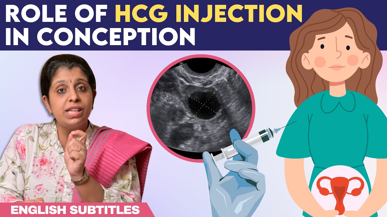 Role Of hCG Injection In Conception | hCG ஊசி செலுத்திய பிறகு கரு ...