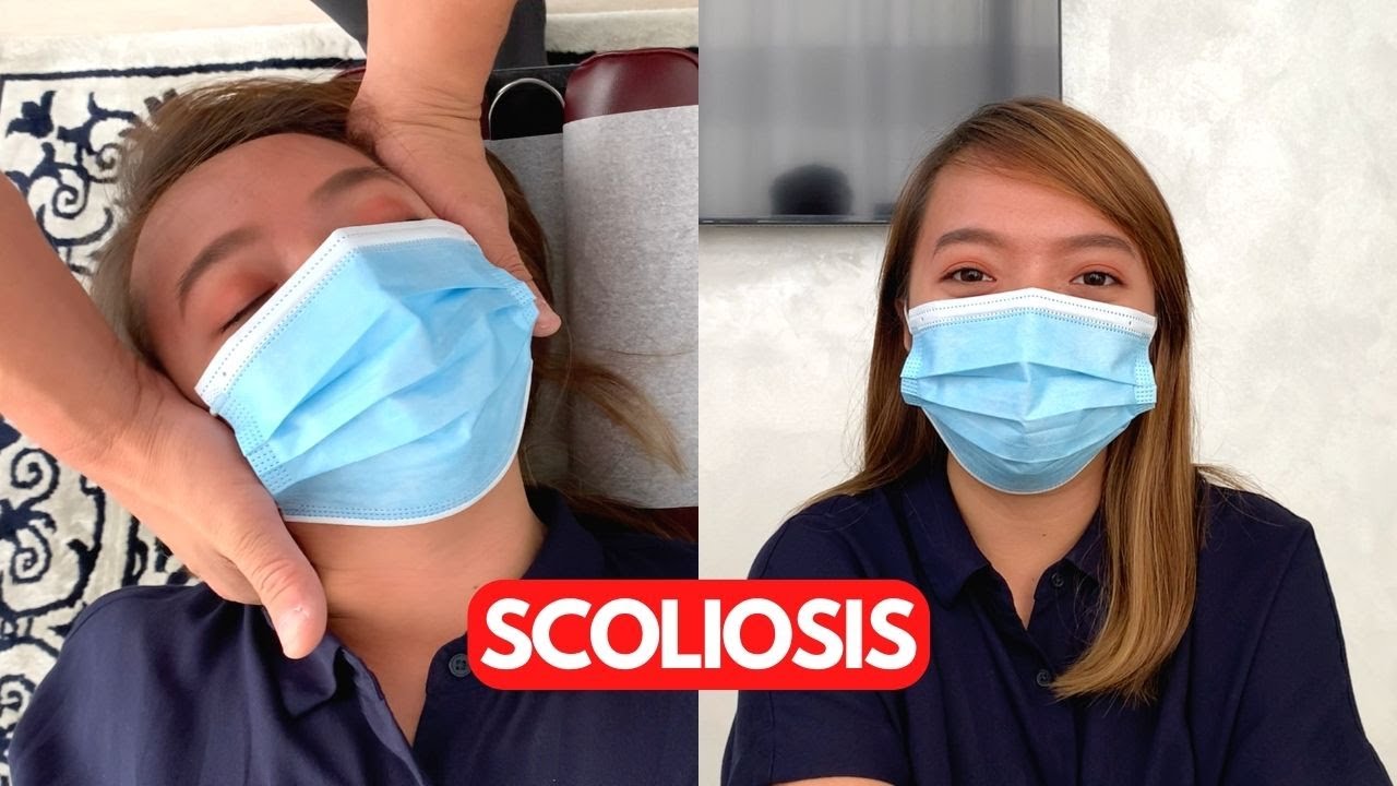 SCOLIOSIS feels better | Doc Kim, Philippines chiropractor - YouTube