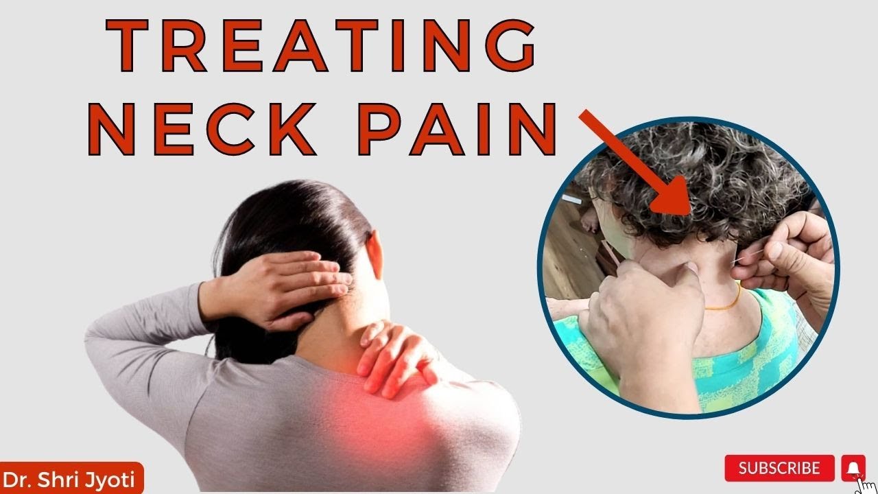 Neck Pain Treatment using 2 Needle Method | CERVICAL SPONDYLOSIS # ...