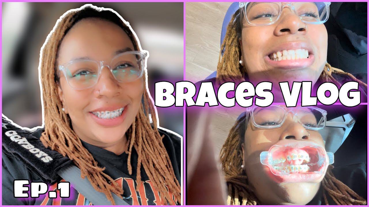 Come With Me To Get Braces Adult Braces Braces Vlog 2023 Youtube