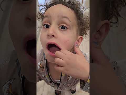 Kuzey dişin kırılmış !! #shorts