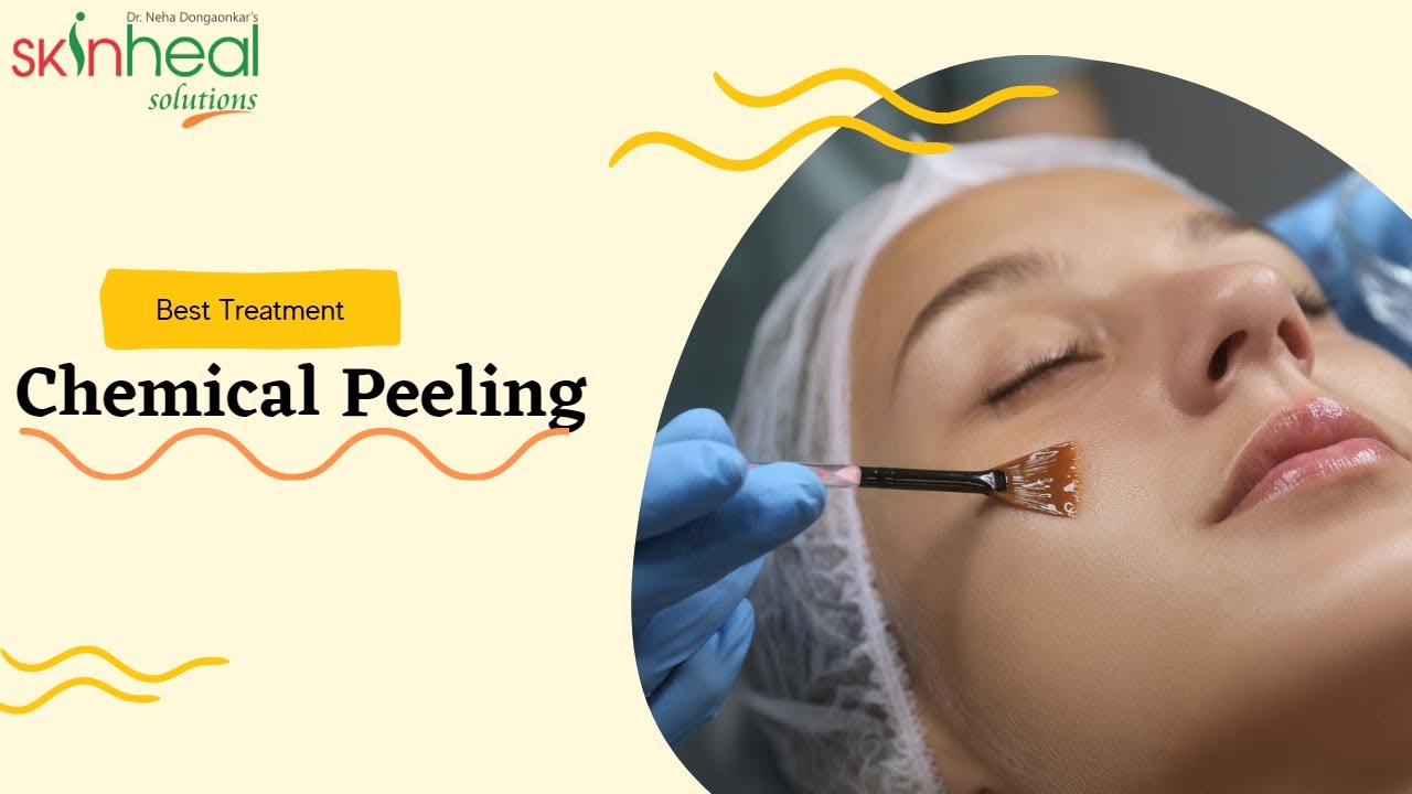 Chemical peeling - Myths and Facts || Dr. Neha Dongaonkar - YouTube