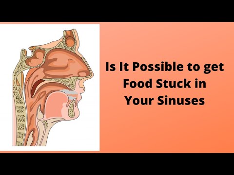 Is It Possible to get Food Stuck in Your Sinuses - YouTube