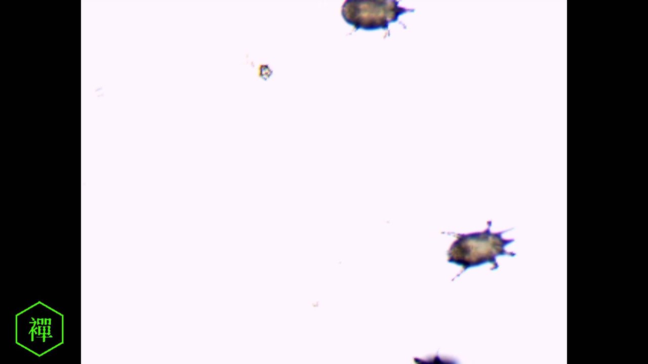 Lepidoglyphus destructor [Hay Mite] Sample 02 - YouTube