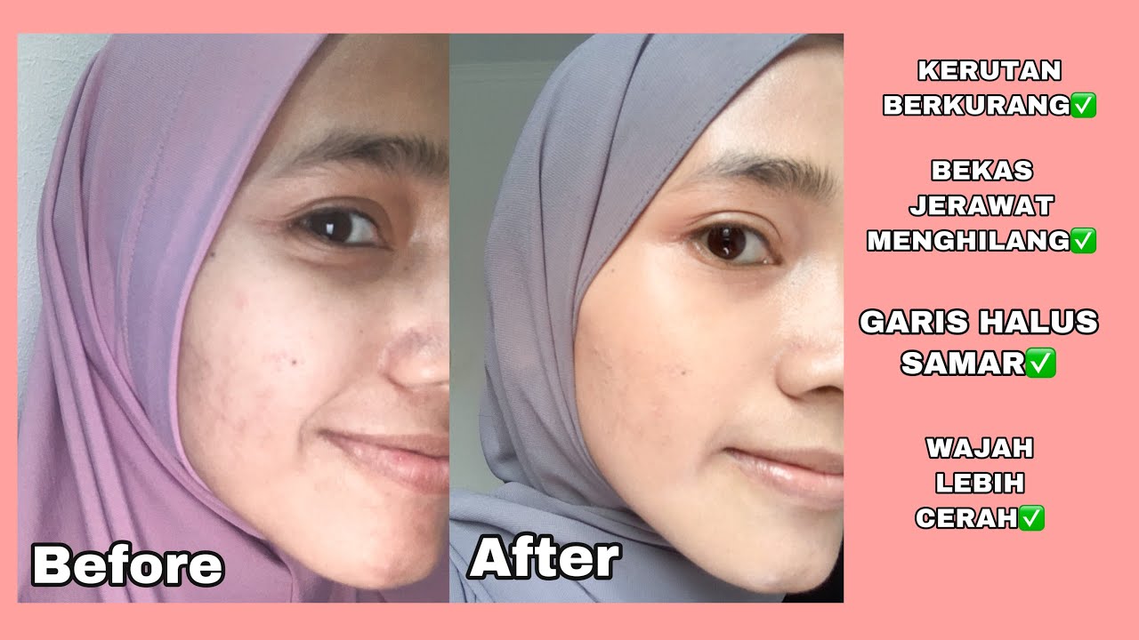 REVIEW ELFORMULA INTENSIVE RETINOL AGE REWIND SERUM - YouTube