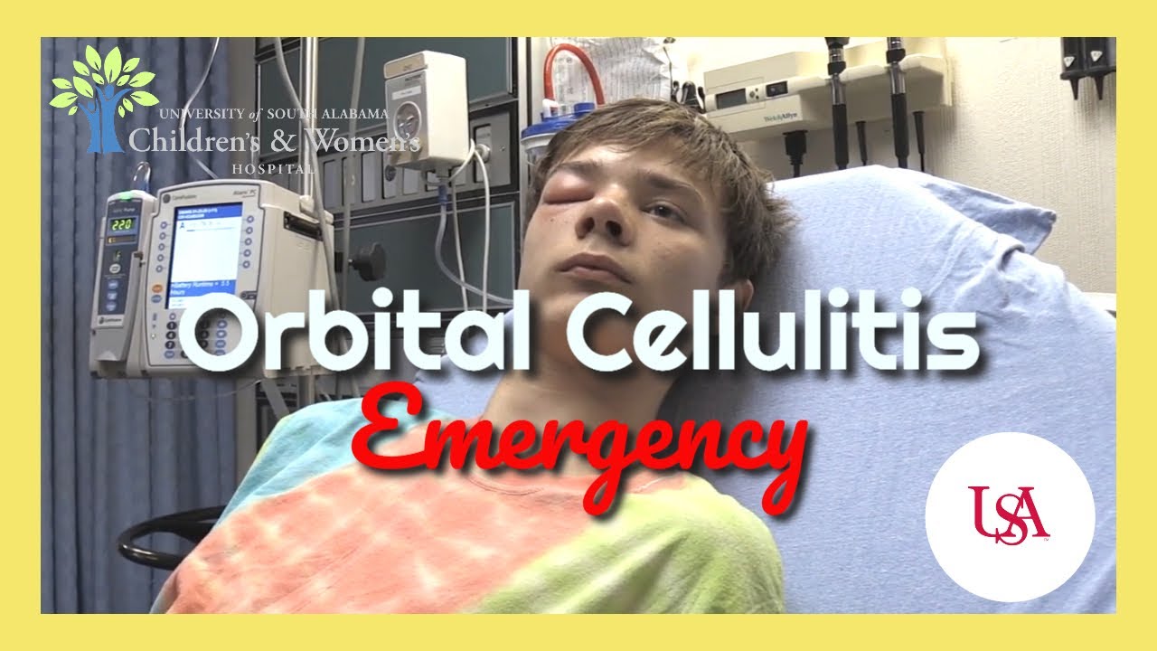 Orbital Cellulitis Emergency - YouTube