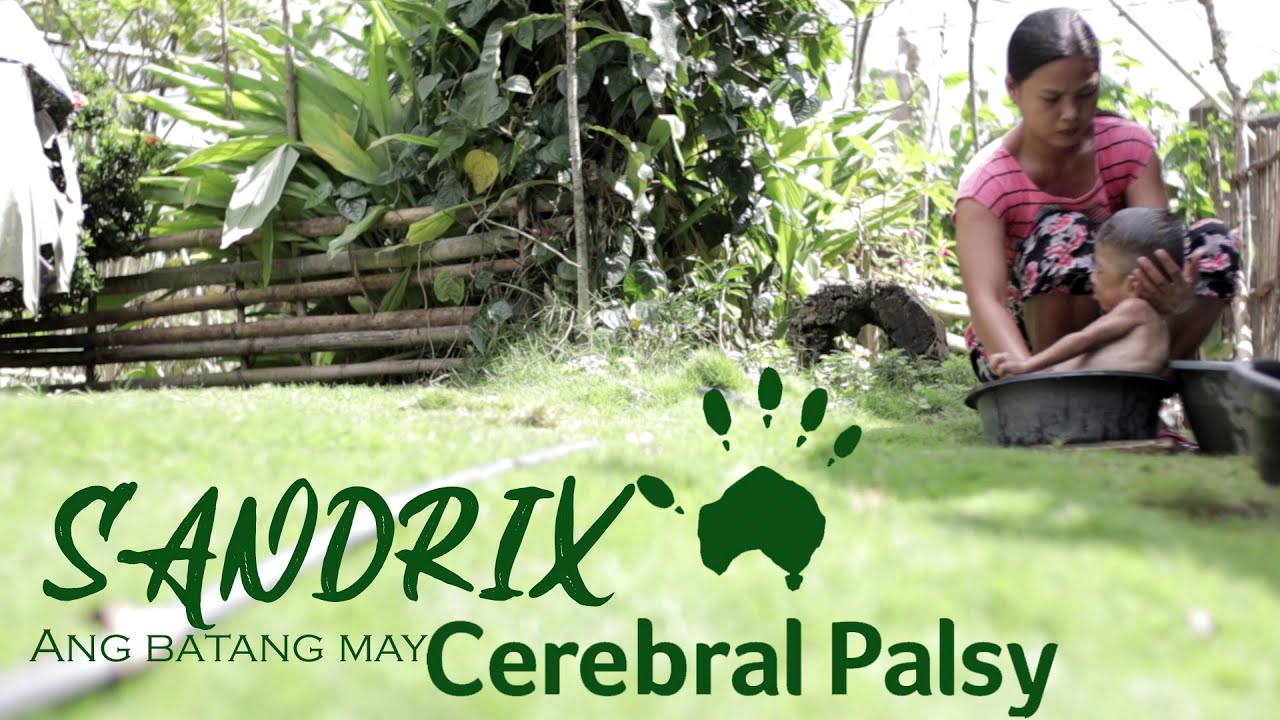 SANDRIX Ang batang may Cerebral Palsy || EsjaySuarilla - YouTube