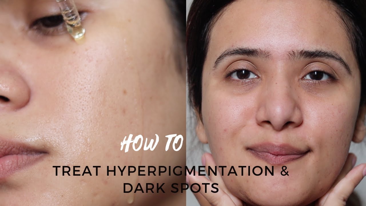 AM to PM routine to Treat Hyperpigmentation & Dark Spots - YouTube